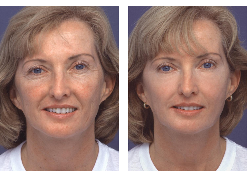 Gio Castel - SKIN ACTIVIST XTREME SERUM®