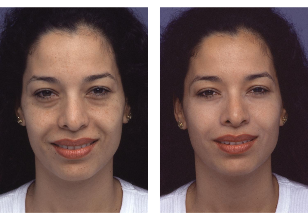 Gio Castel - SKIN ACTIVIST XTREME SERUM®