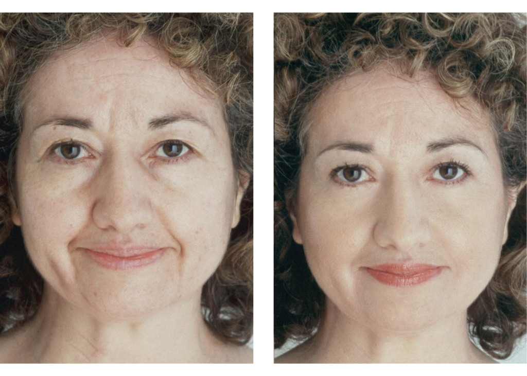 Gio Castel - SKIN ACTIVIST XTREME SERUM®