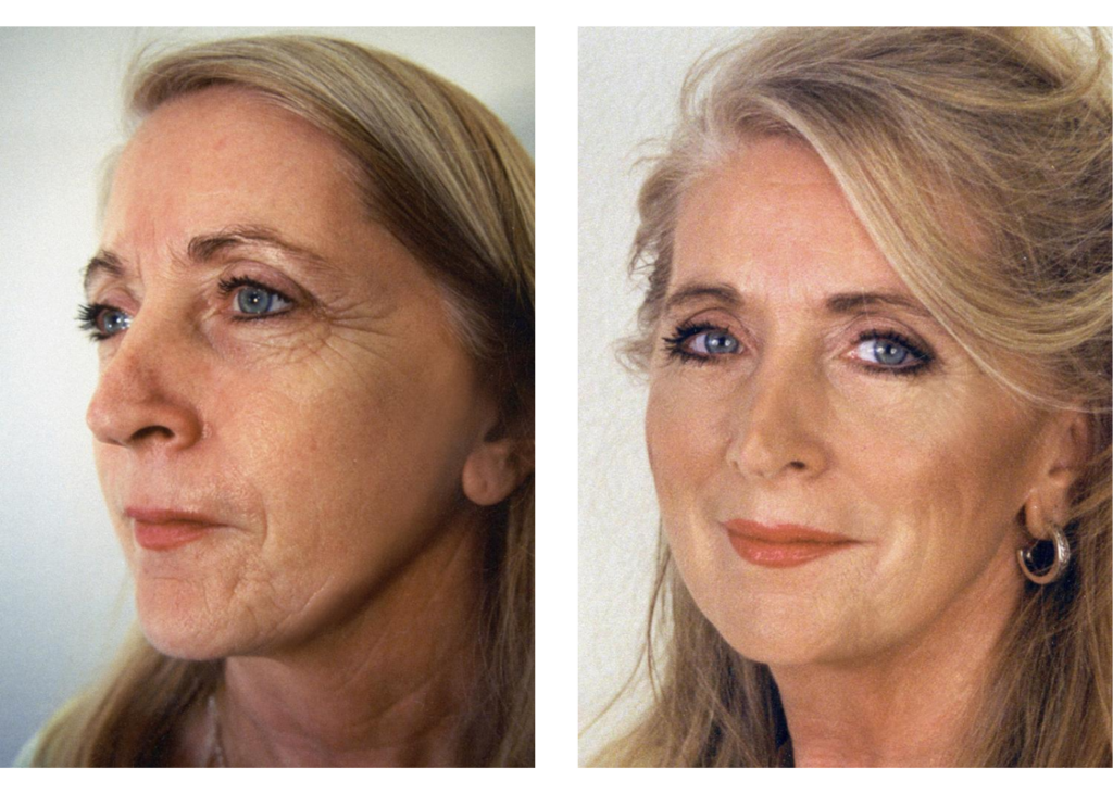 Gio Castel - SKIN ACTIVIST XTREME SERUM®